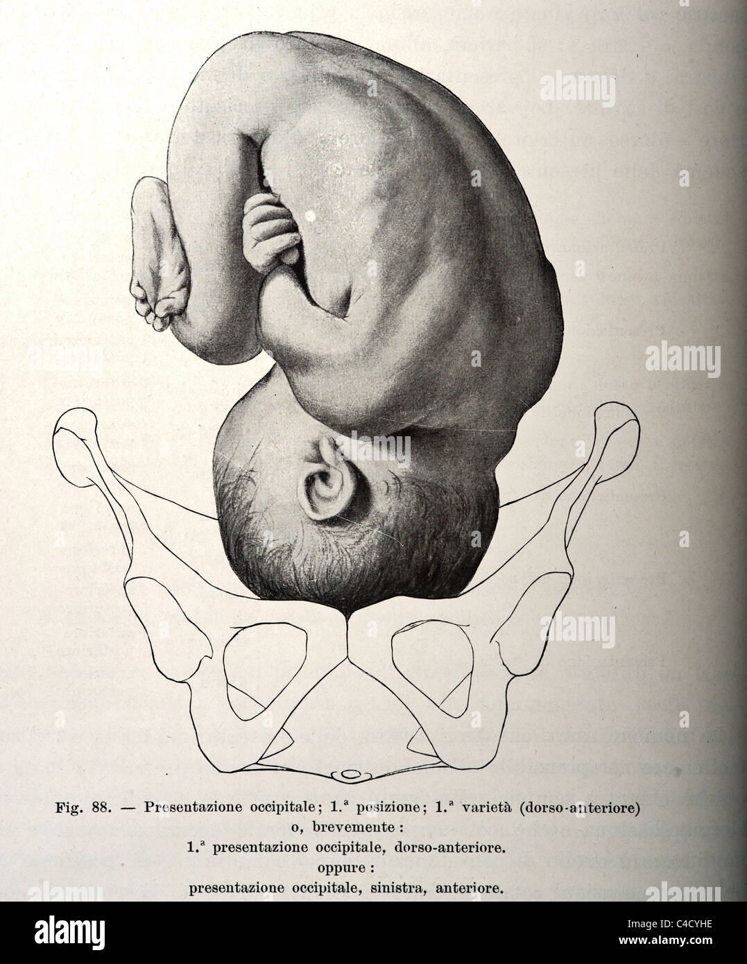 Illustration of Human Fetus copyright 1905 Stock Photo - Alamy
