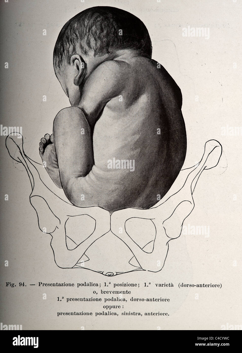 Illustration of Human Fetus copyright 1905 Stock Photo - Alamy