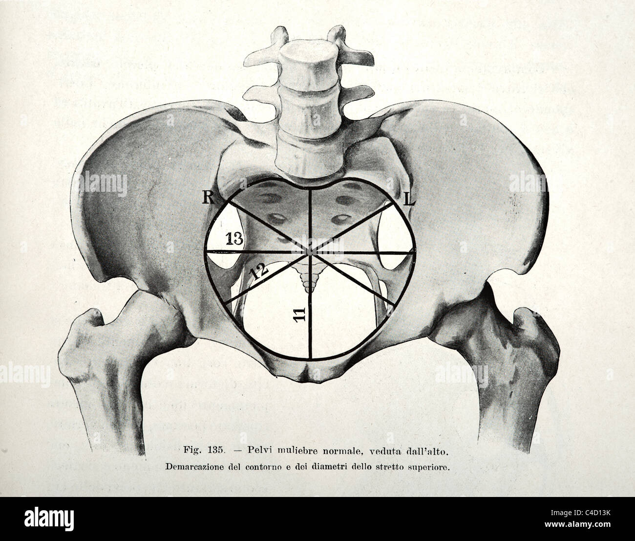 Pelvic brim hi-res stock photography and images - Alamy