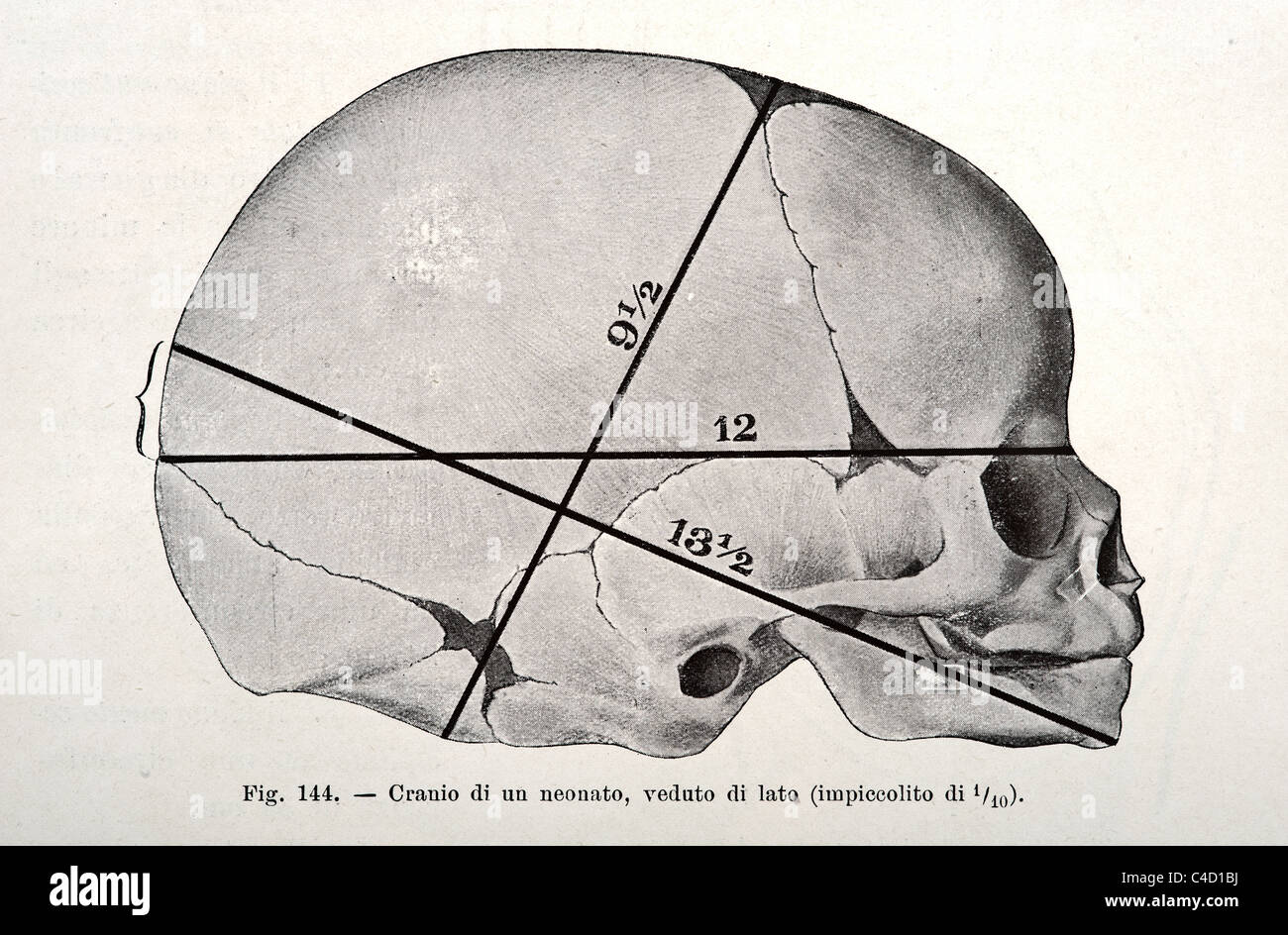 Antique medical illustration of skull, cranium, brain, head, face Stock ...