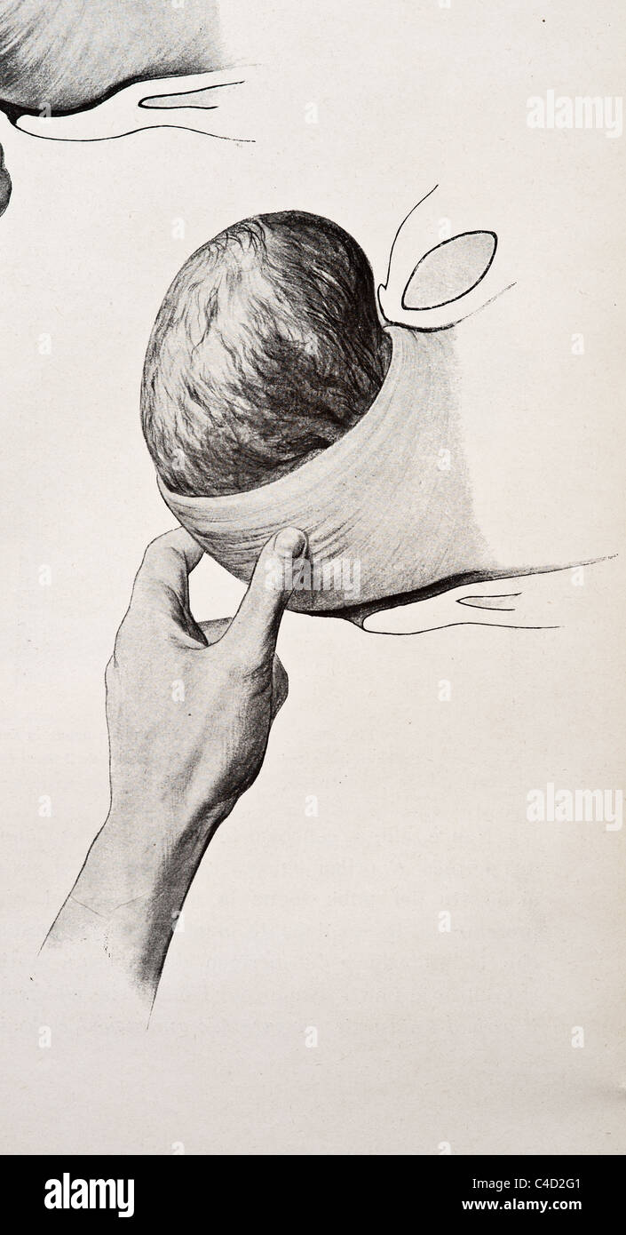 Birth Canal Illustration High Resolution Stock Photography and Images ...