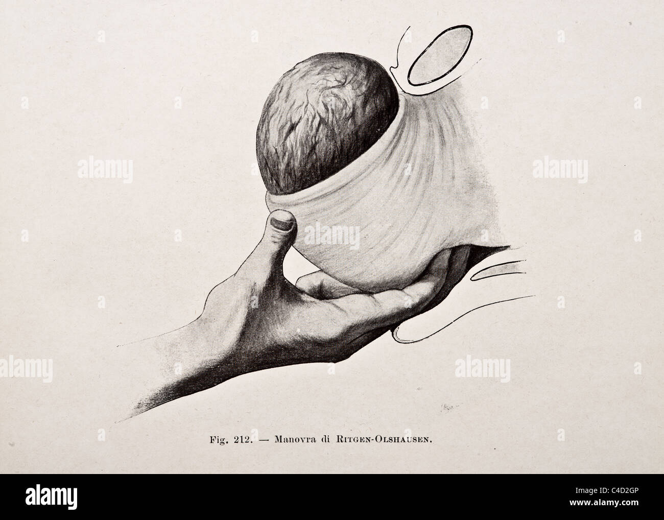 Birth Canal Illustration High Resolution Stock Photography and Images ...