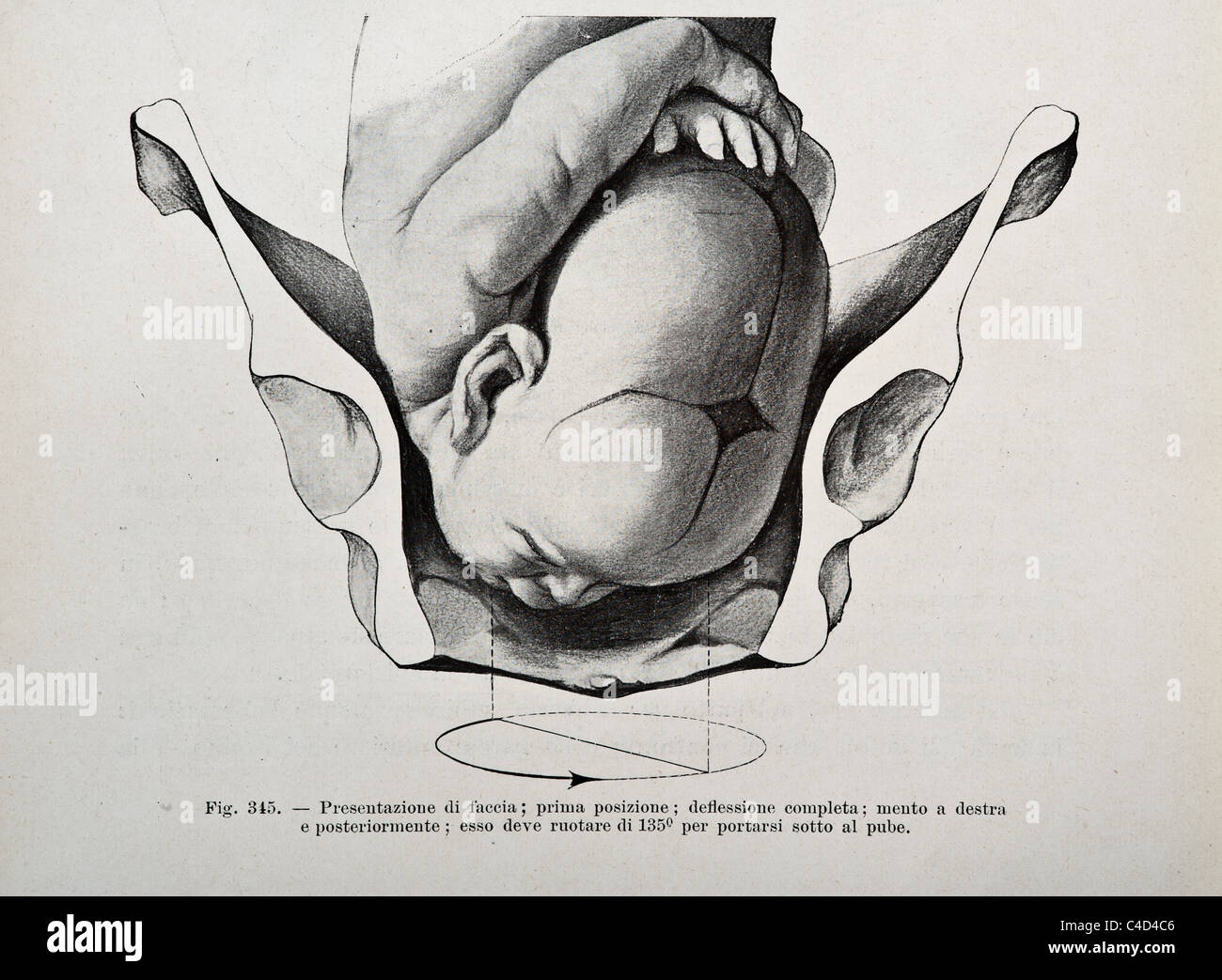 Baby pelvis illustration hi-res stock photography and images - Alamy