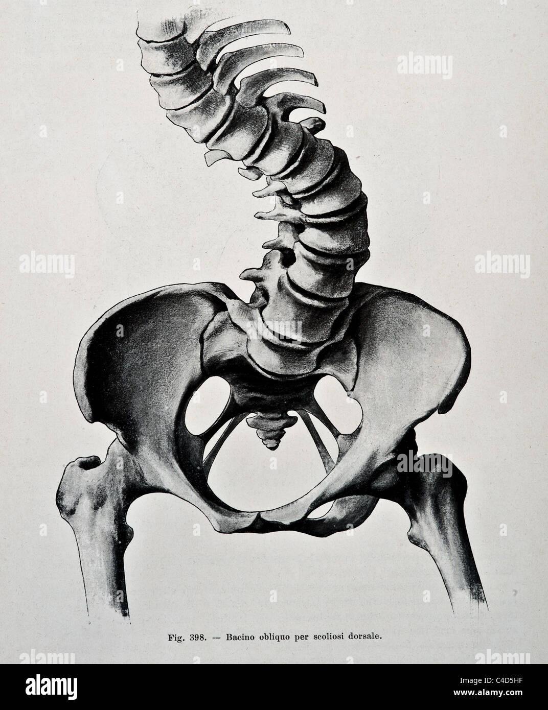 Illustration of Human Pelvis copyright 1905 Stock Photo - Alamy