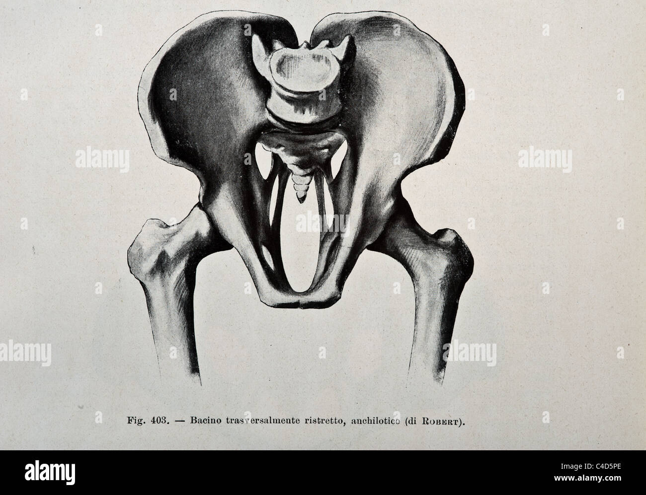 Illustration of Human Pelvis copyright 1905 Stock Photo - Alamy