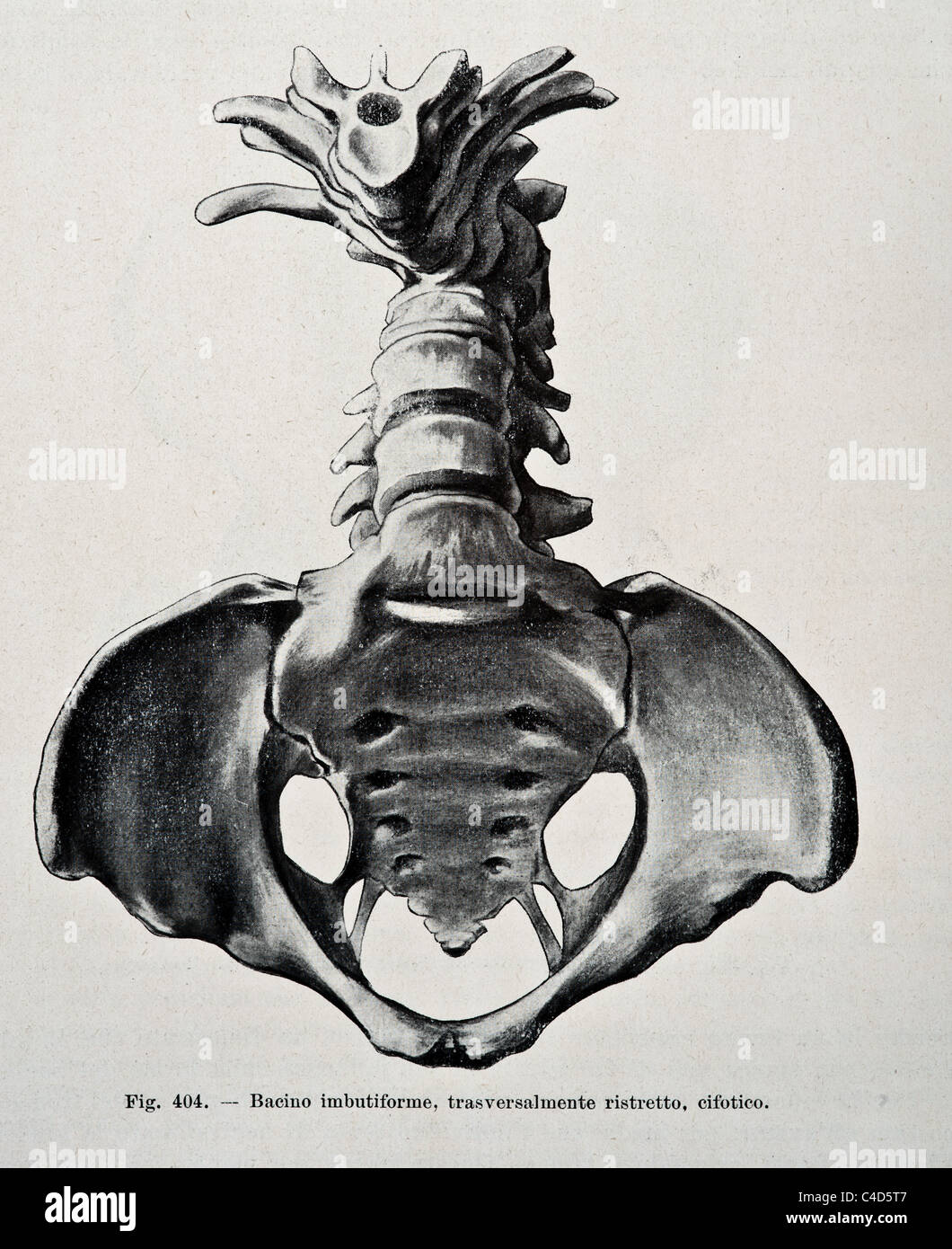 Illustration of Human Pelvis copyright 1905 Stock Photo - Alamy