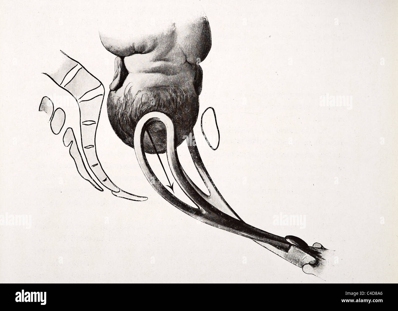 Birth Canal Illustration High Resolution Stock Photography and Images ...