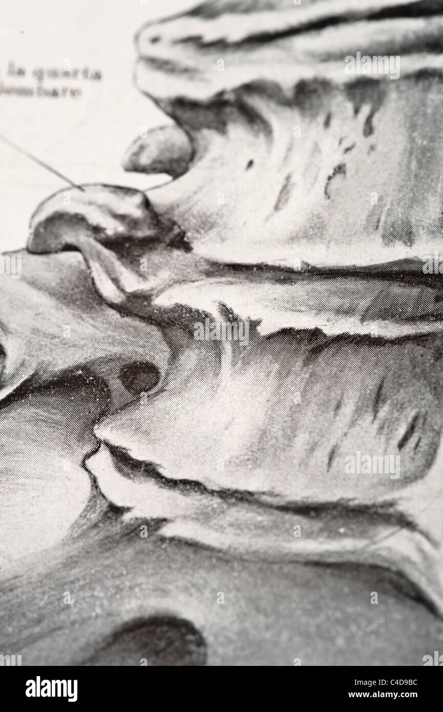 Antique Medical Illustration of a Spine Stock Photo - Alamy