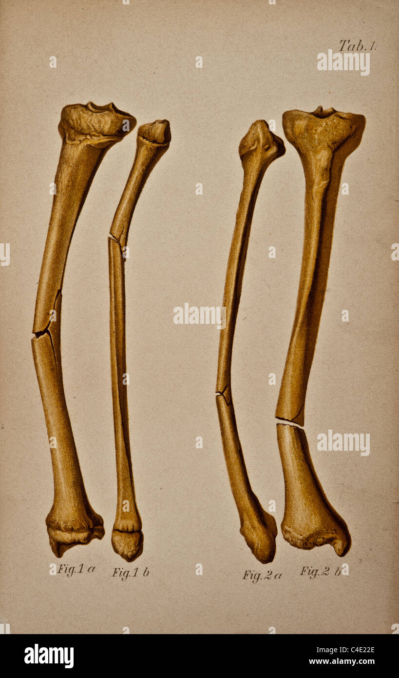 Tibia and fibula hi-res stock photography and images - Alamy