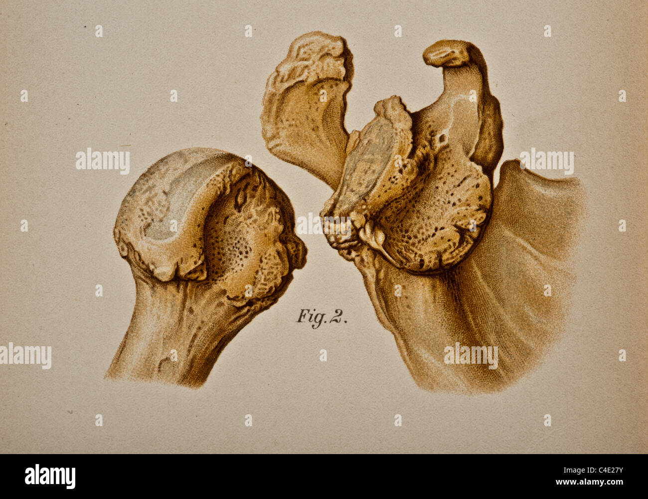 Ball socket joint anatomy hi-res stock photography and images - Alamy