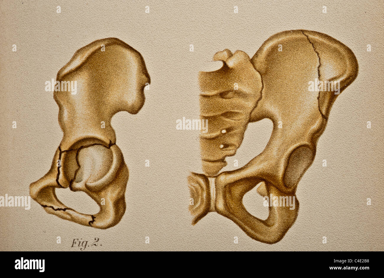 Joint dislocations hi-res stock photography and images - Alamy