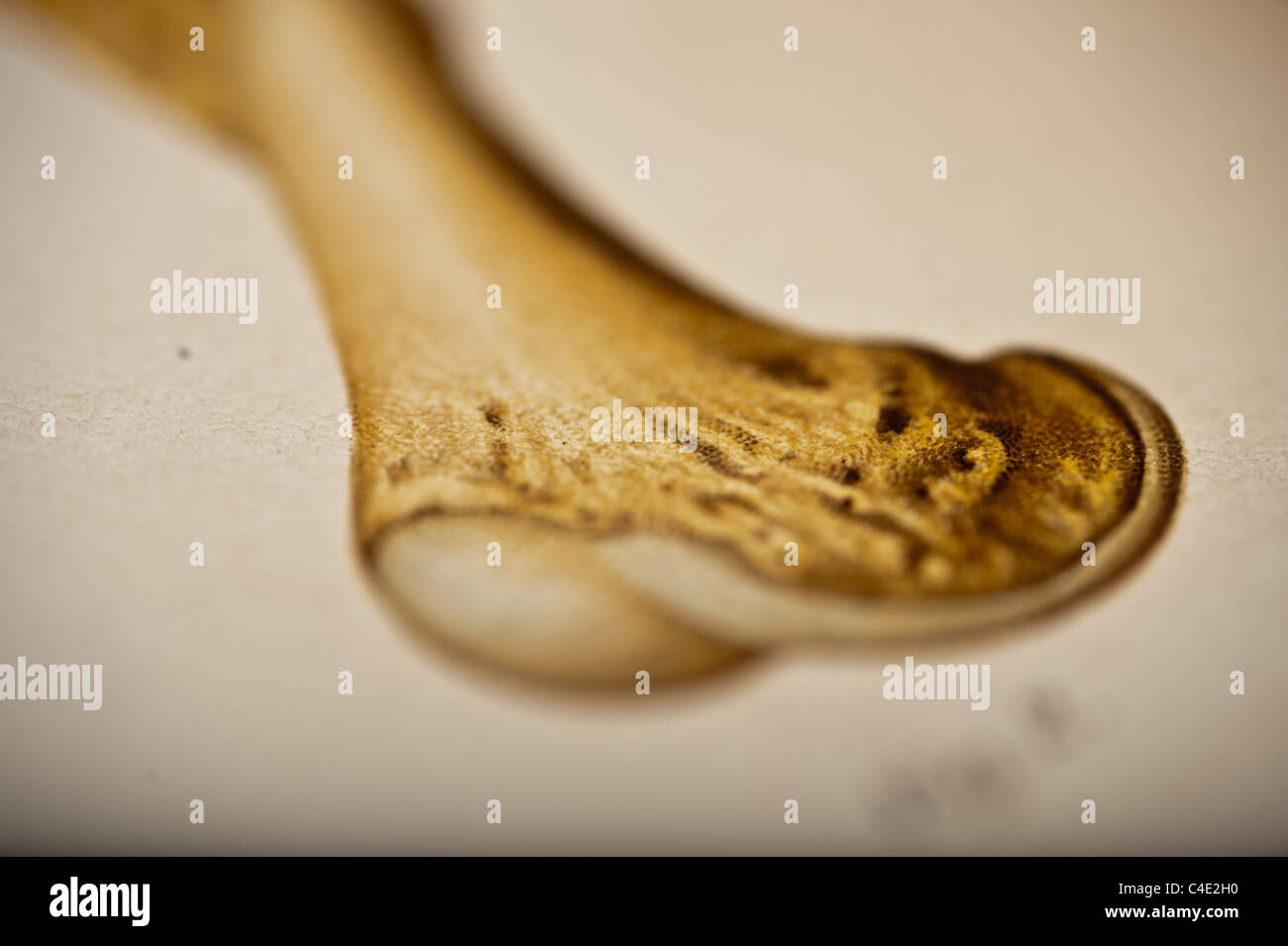 Antique medical illustration of a hip bone, ball & socket Stock Photo ...