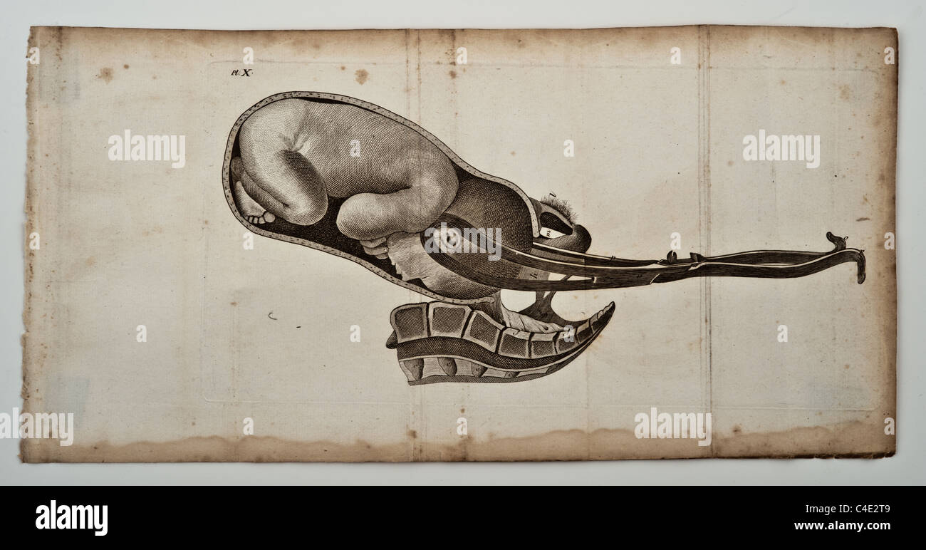 Illustration of a Human Birth copyright 1822 Stock Photo - Alamy