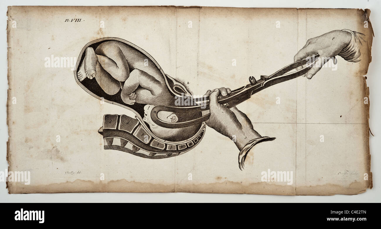 Birth canal illustration hi-res stock photography and images - Alamy