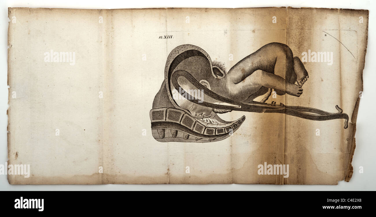 Illustration of a Human Birth copyright 1822 Stock Photo - Alamy