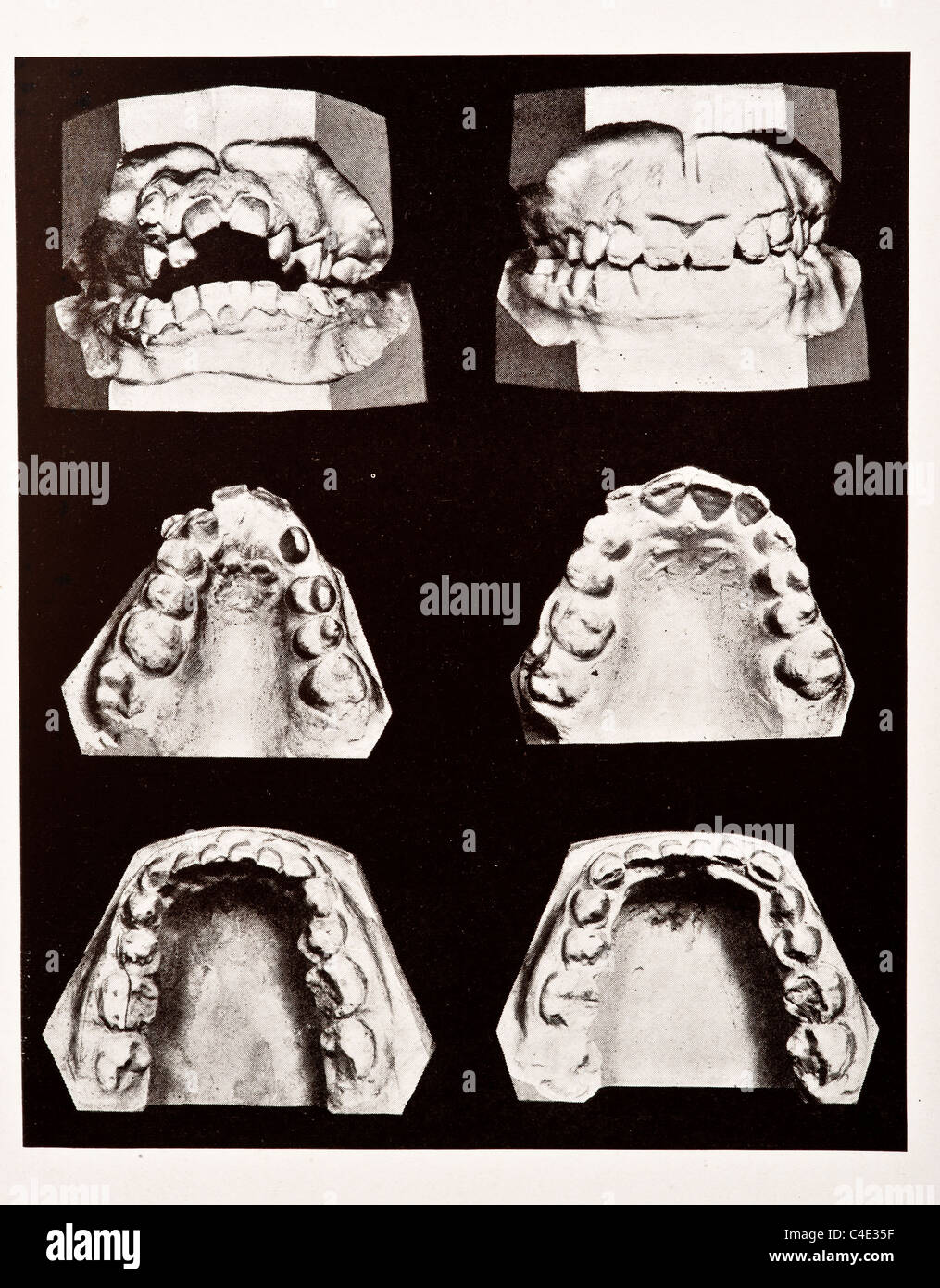 Illustration of Human Teeth Models copyright 1911 Stock Photo - Alamy