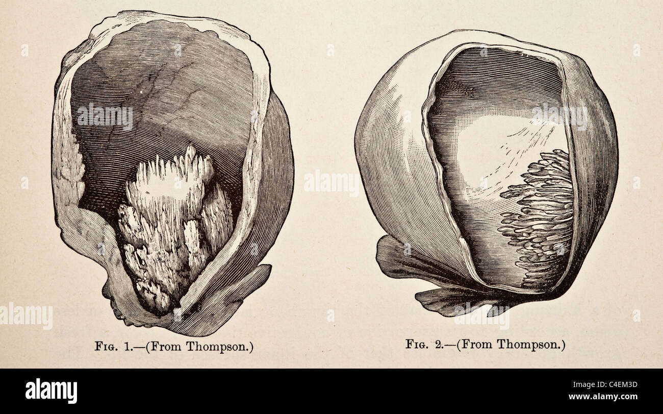 Genito urinary hi-res stock photography and images - Alamy