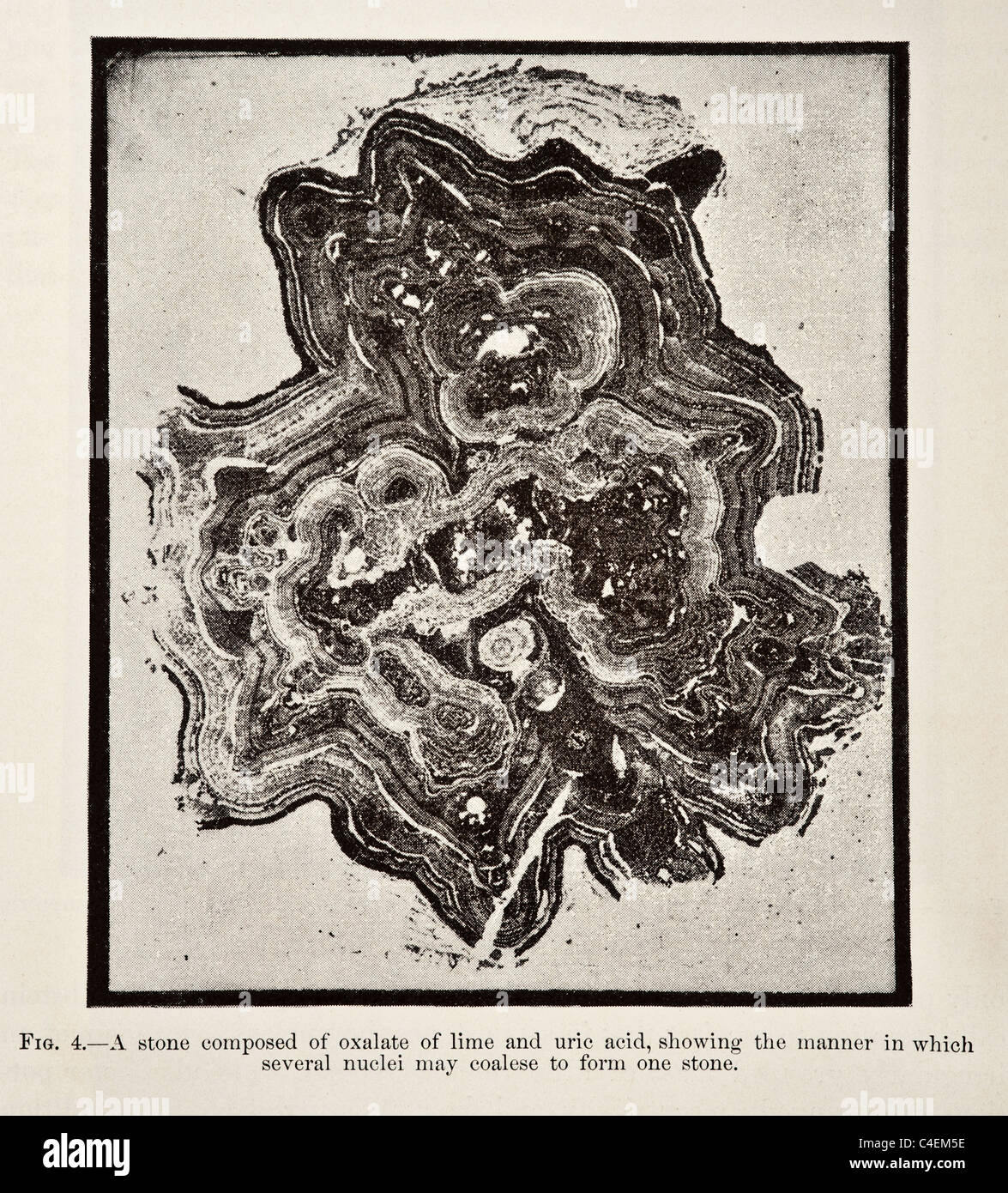 Genito-Urinary Diseases Syphilology and Dermatology copyright 1893 ...