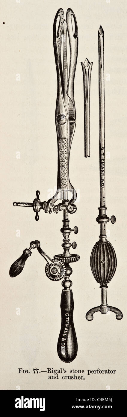 Antique Illustration of Surgical Tools and Medical Apparatus Stock ...