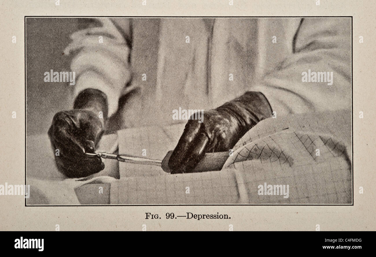 Urology in Men Women and Children by Victor Pedersen copyright 1919 ...