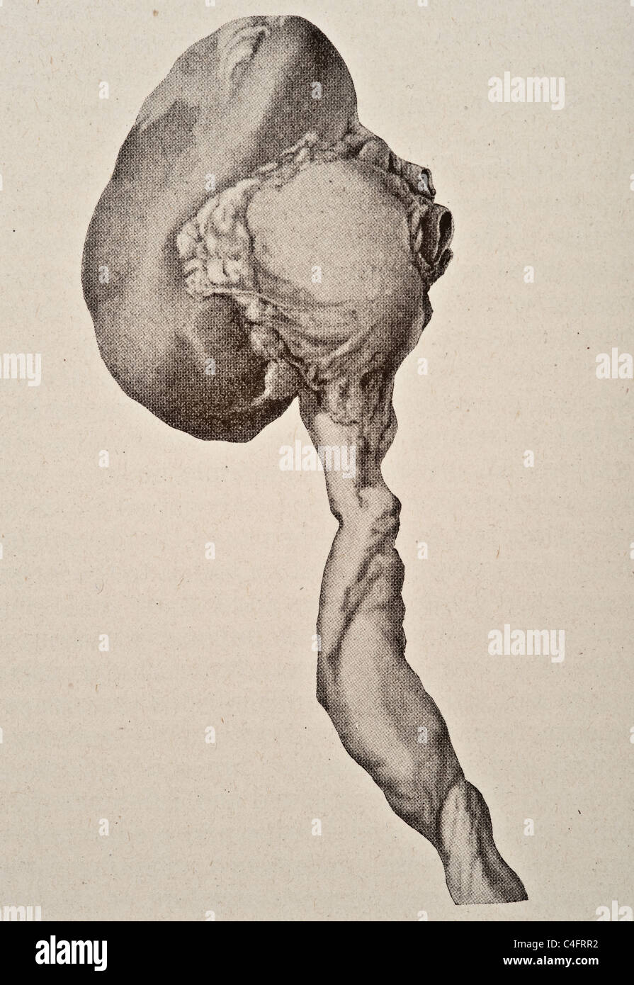 Urology in Men Women and Children by Victor Pedersen copyright 1919 ...