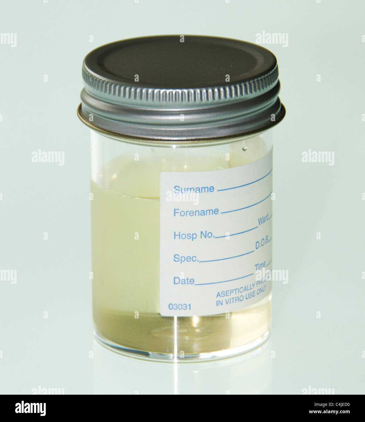 A urine sample for medical analysis. Human. UK Stock Photo - Alamy