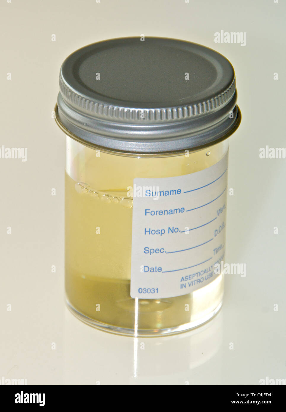 A urine sample for medical analysis. Human. UK Stock Photo - Alamy