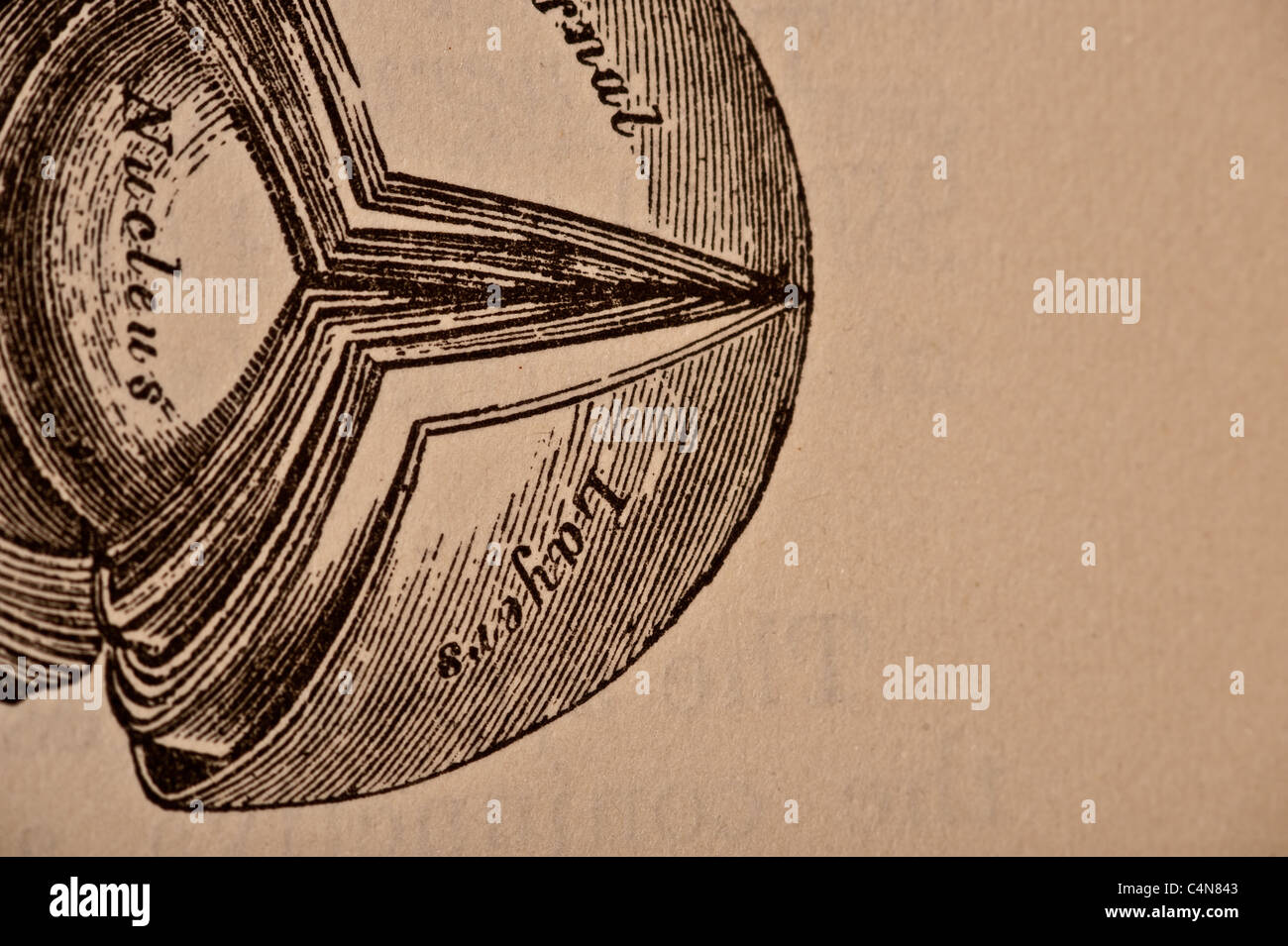 Antique medical illustration of eye disease and Ophthalmologic surgery ...