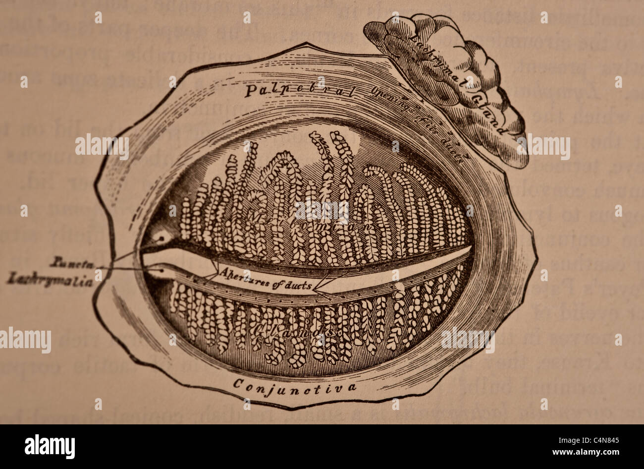 Antique medical illustration of eye disease and Ophthalmologic surgery ...