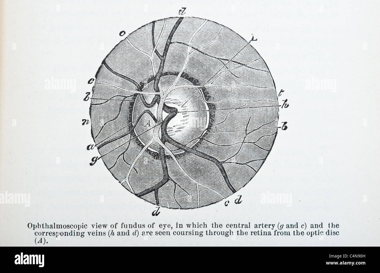 Antique medical illustration of eye disease and Ophthalmologic surgery ...