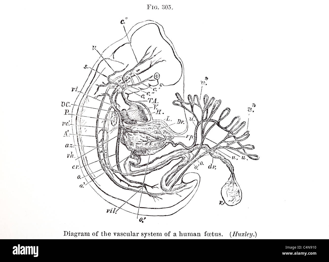 1800s anatomy antique autopsy human body illustration medical medicine ...