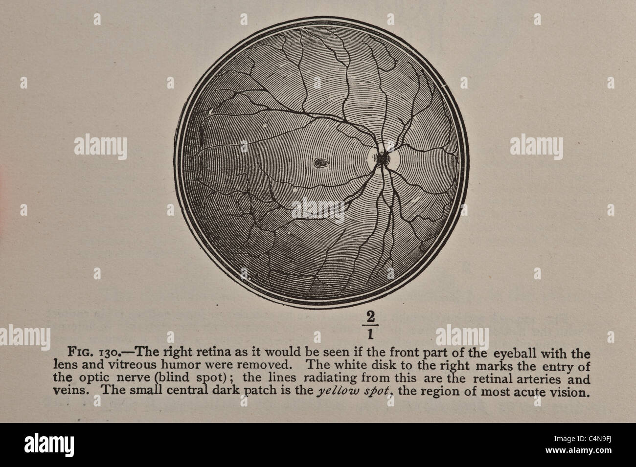 Antique medical illustration of eye disease and Ophthalmologic surgery ...