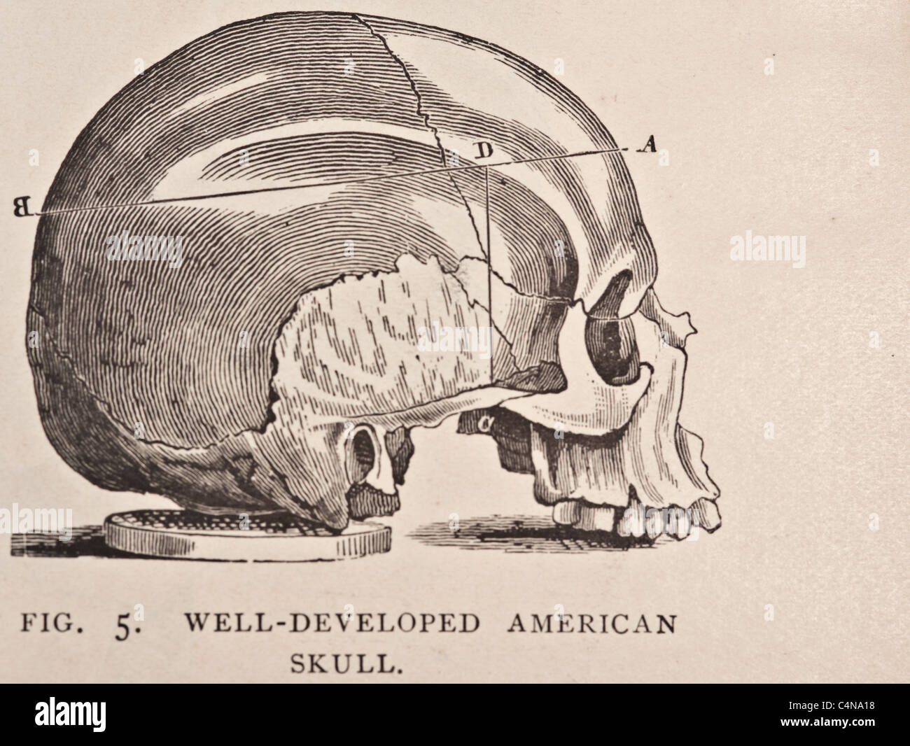 Antique medical illustration of skull, cranium, brain, head, face Stock ...