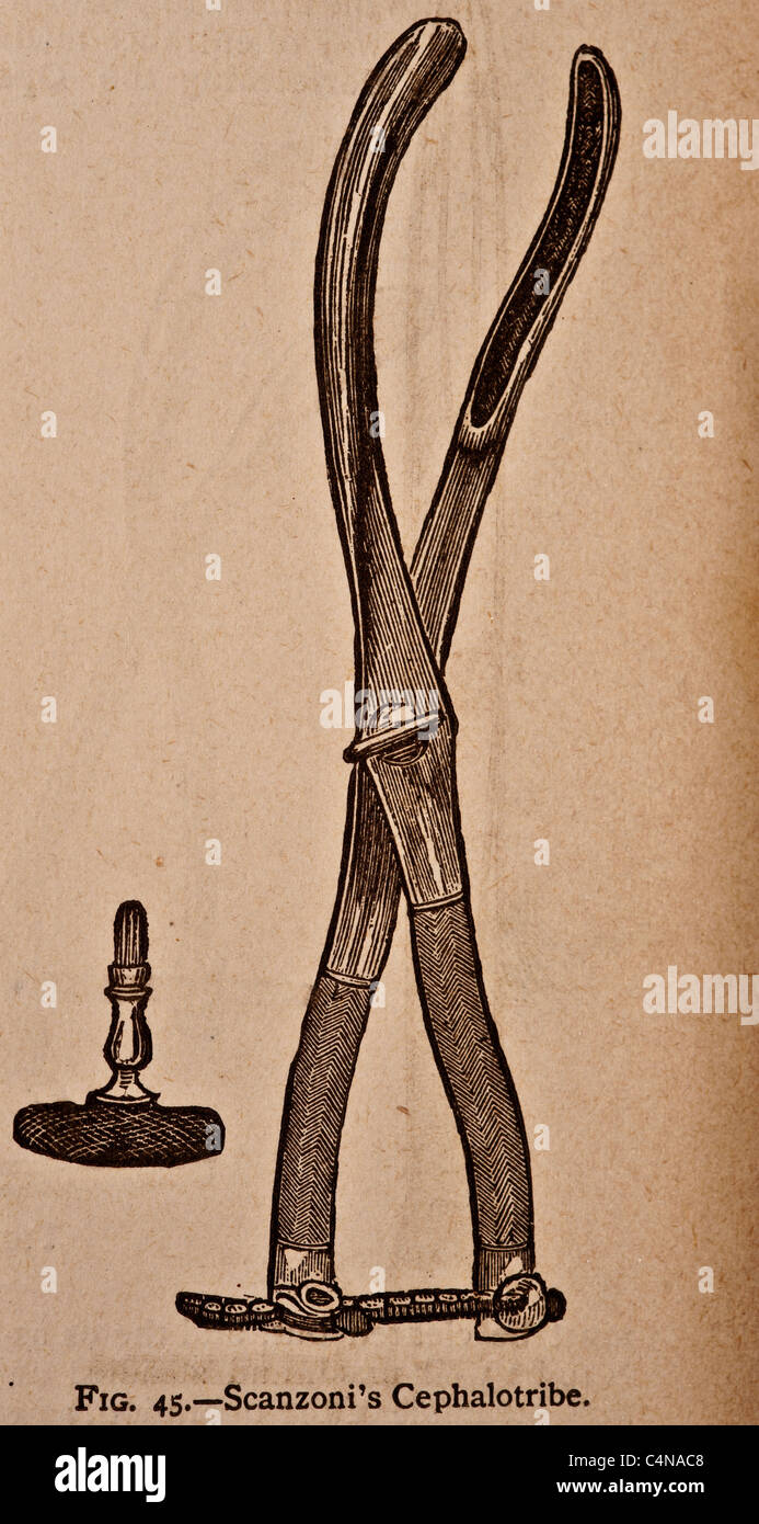 Antique Illustration of Surgical Tools and Medical Apparatus Stock ...