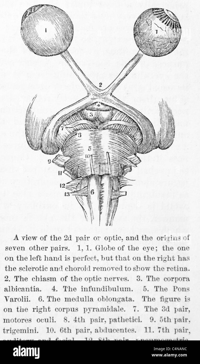 Antique medical illustration of eye disease and Ophthalmologic surgery ...