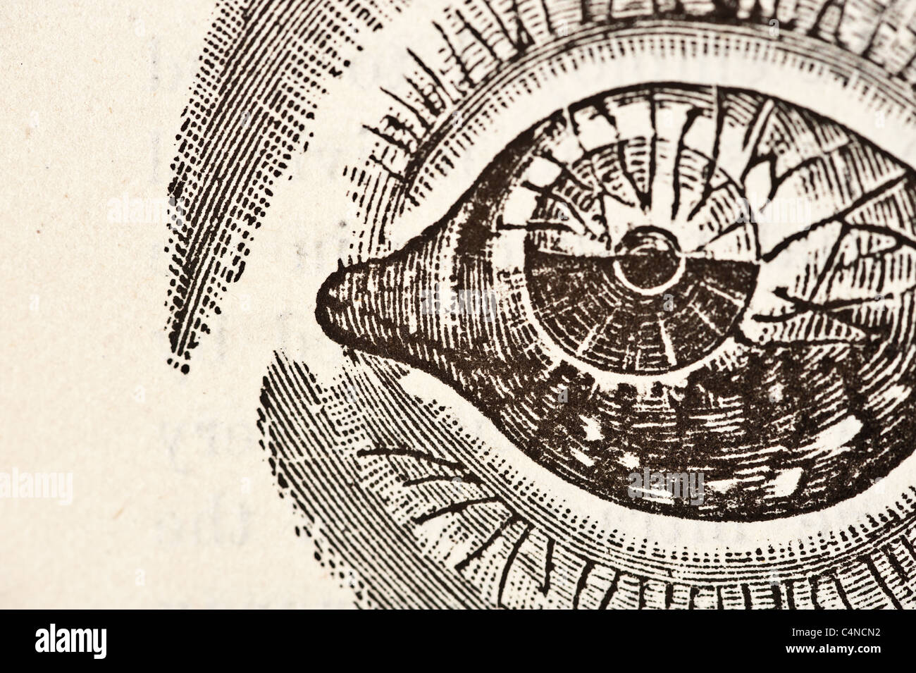Antique medical illustration of eye disease and Ophthalmologic surgery ...