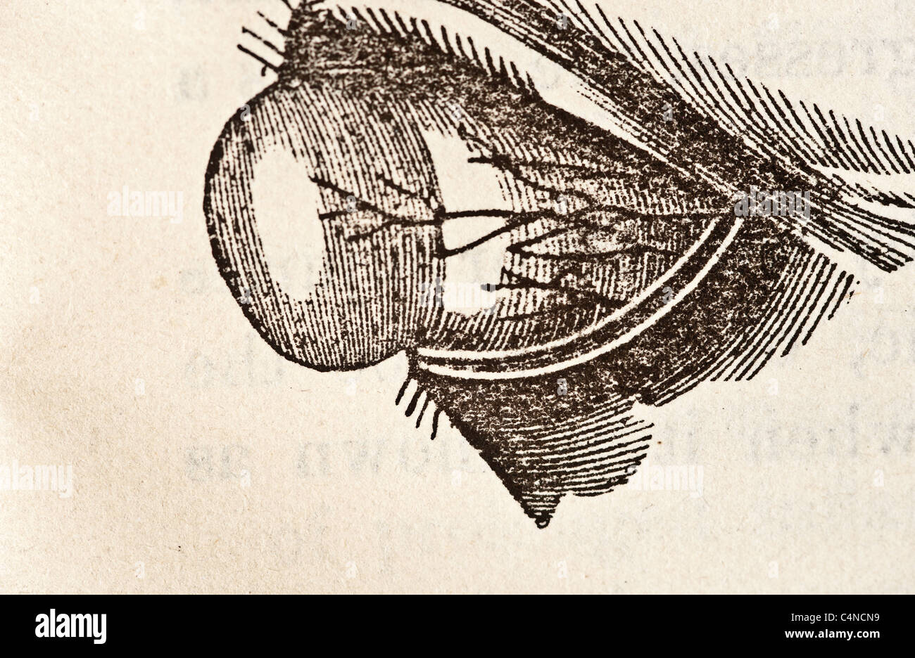 Antique medical illustration of eye disease and Ophthalmologic surgery ...