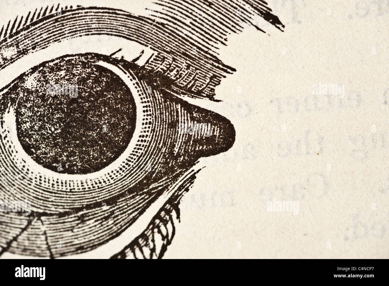 Antique medical illustration of eye disease and Ophthalmologic surgery ...
