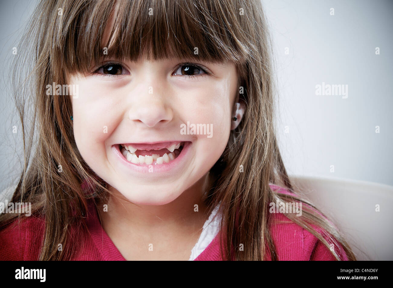 Young girl smiling and showing missing front teeth, Otterburn Park ...