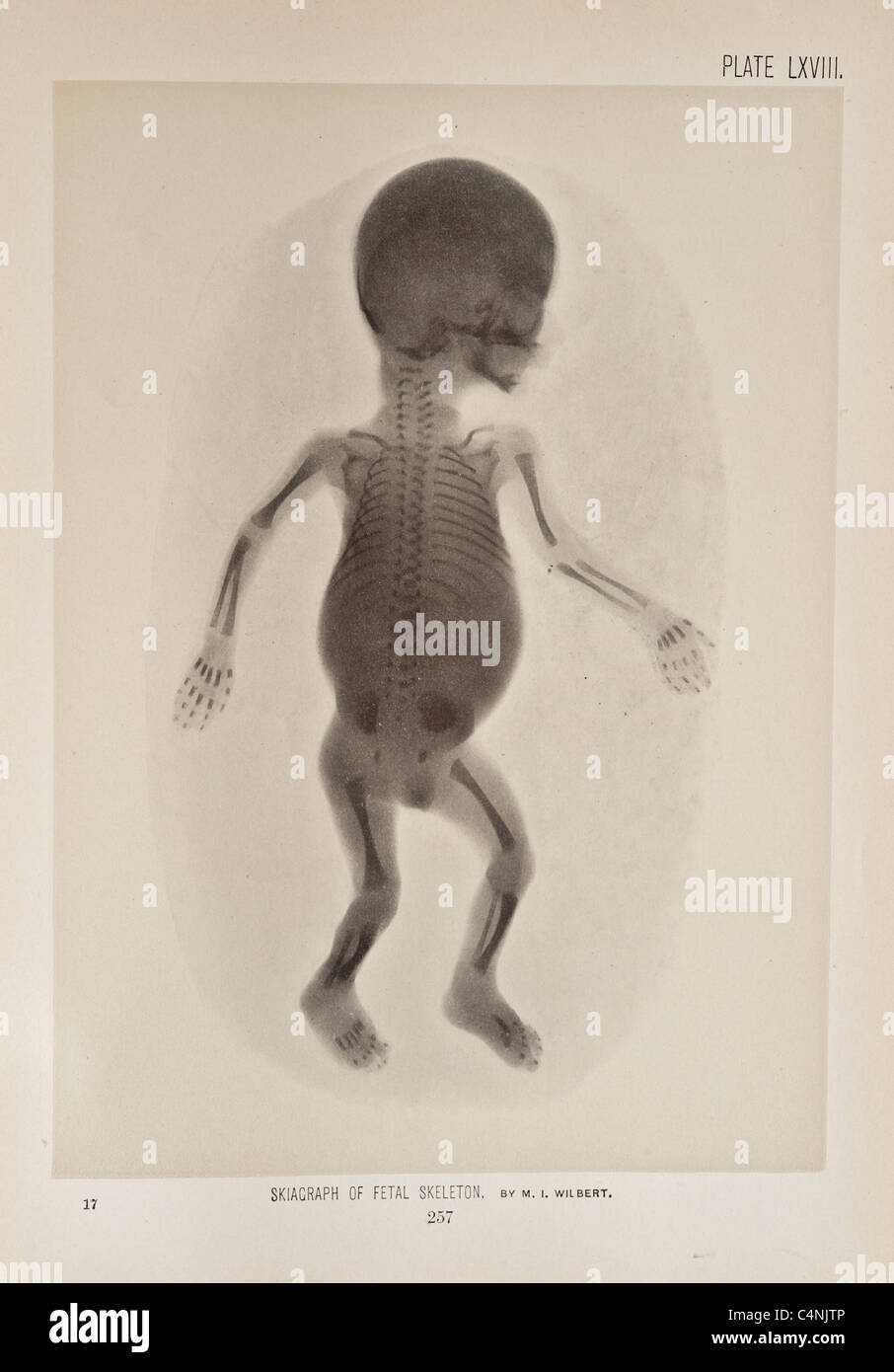 John B Deaver Surgical Anatomy copyright 1899 Stock Photo - Alamy