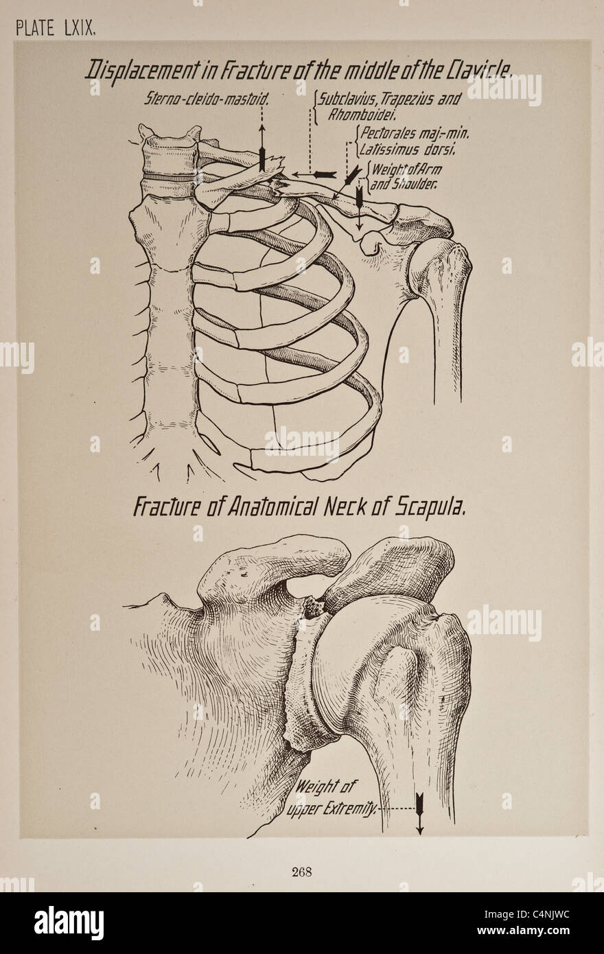 John B Deaver Surgical Anatomy copyright 1899 Stock Photo - Alamy