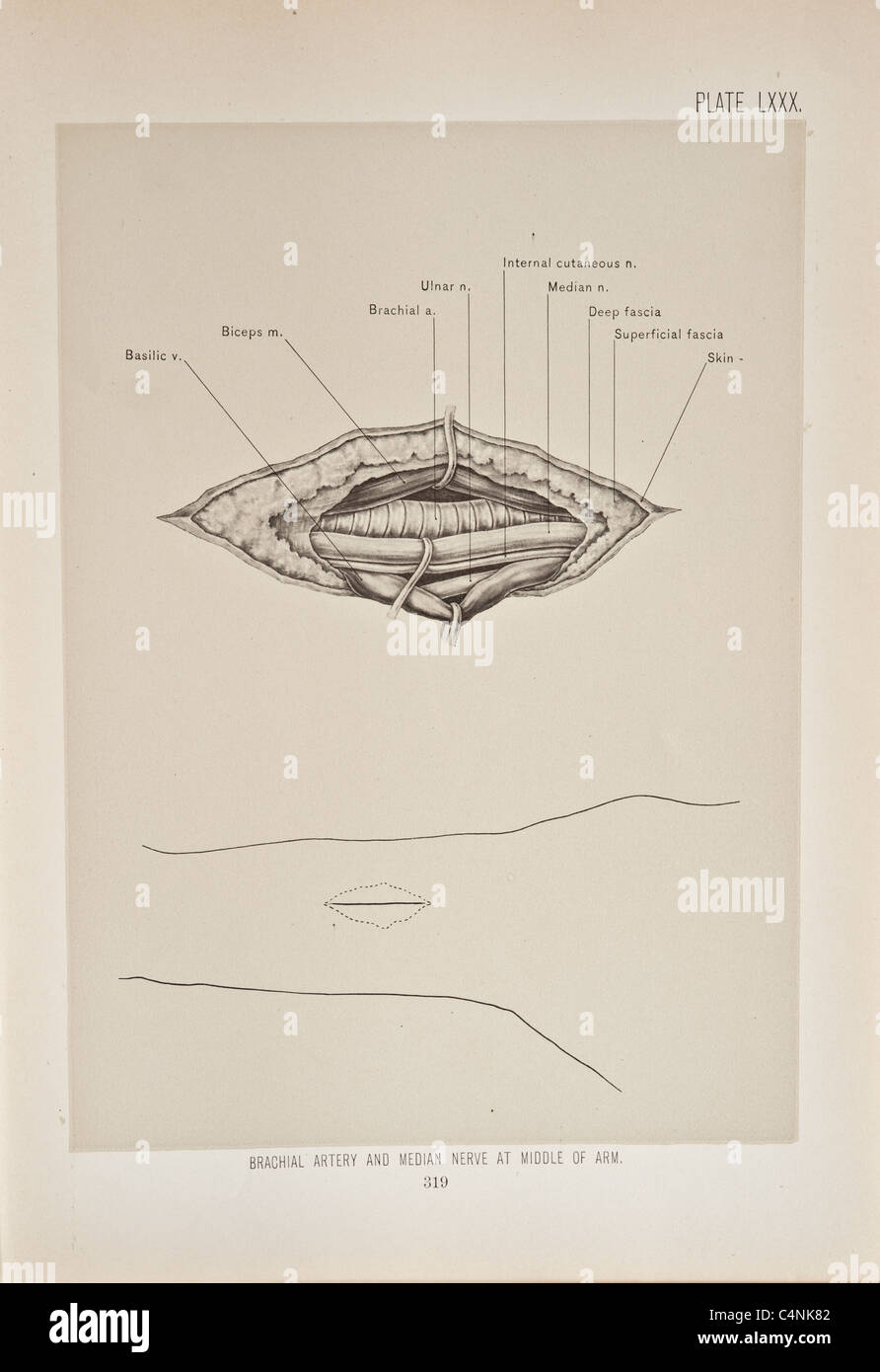 John B Deaver Surgical Anatomy copyright 1899 Stock Photo - Alamy