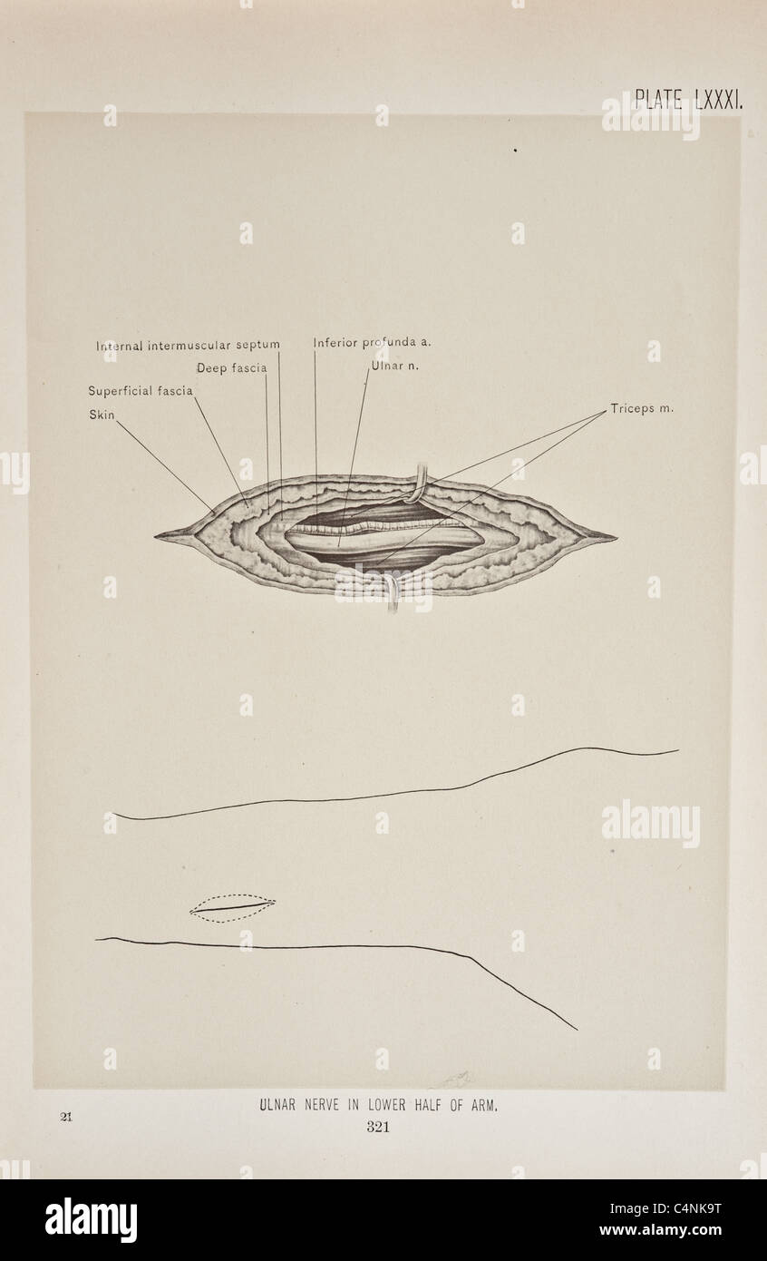 John B Deaver Surgical Anatomy copyright 1899 Stock Photo - Alamy