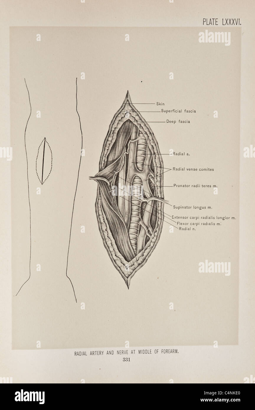 John deaver surgical anatomy copyright hi-res stock photography and ...