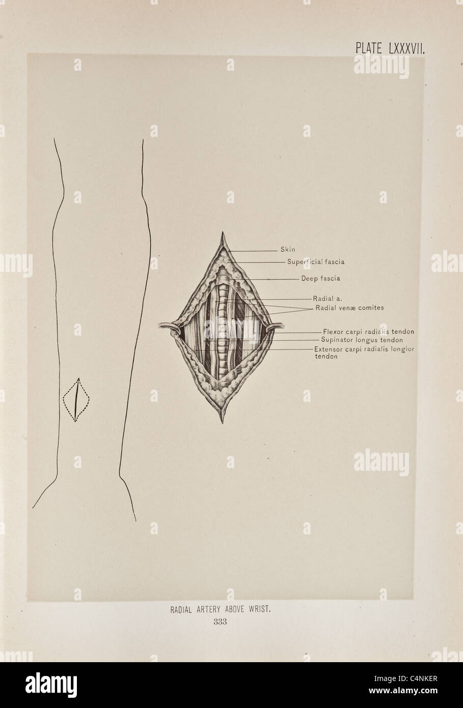 John B Deaver Surgical Anatomy copyright 1899 Stock Photo - Alamy
