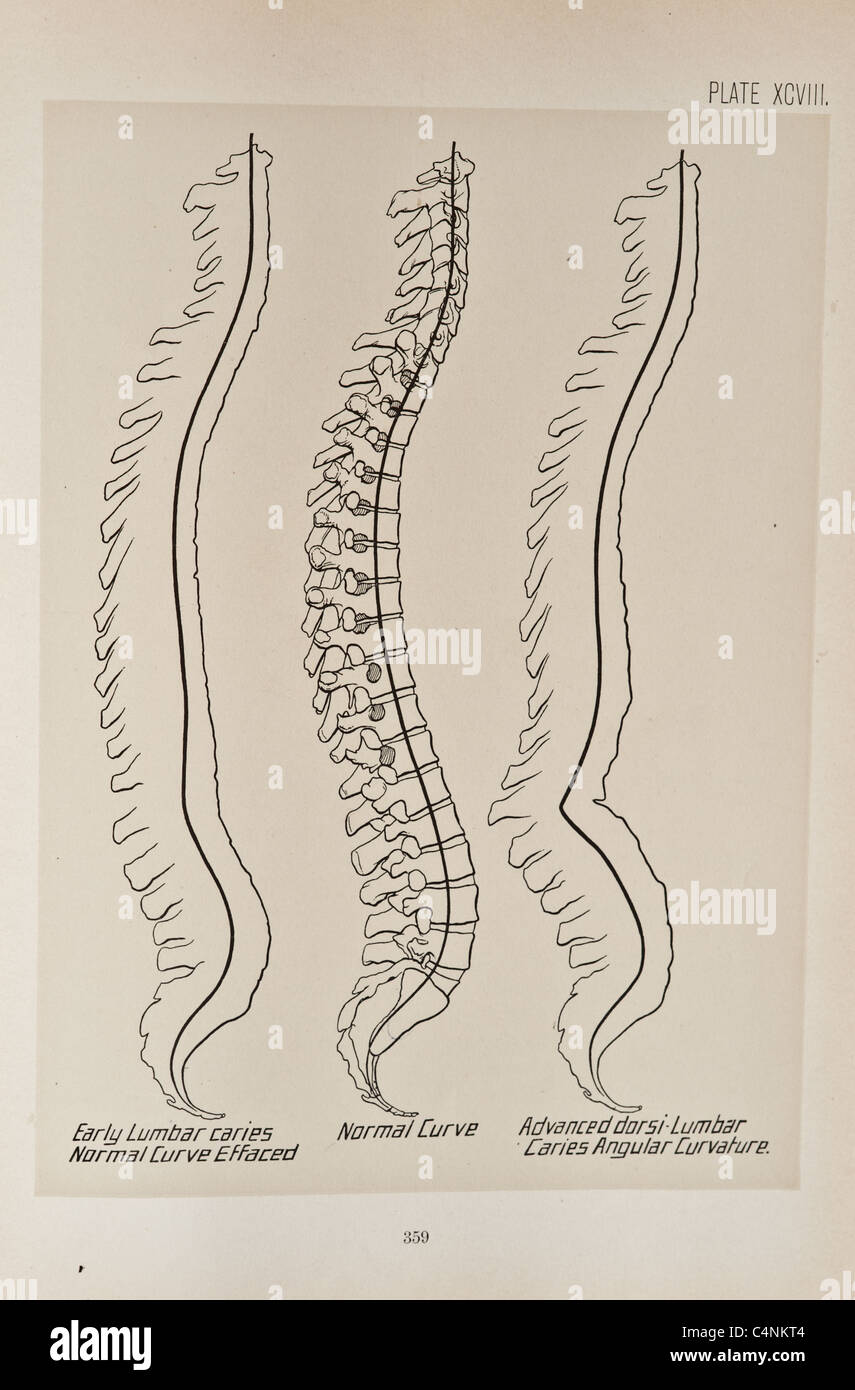 Illustration of the Human Spine copyright 1899 Stock Photo - Alamy