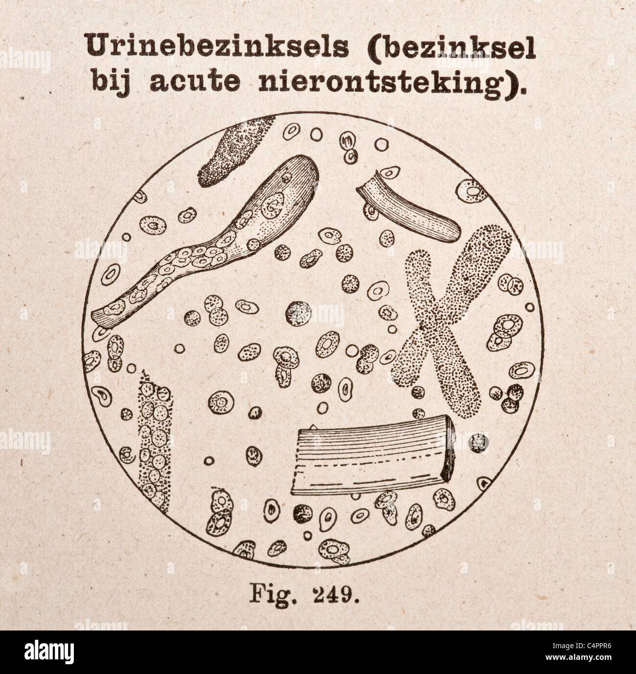 Antique Vintage Medical Illustration of Urine Deposits Sediment in ...