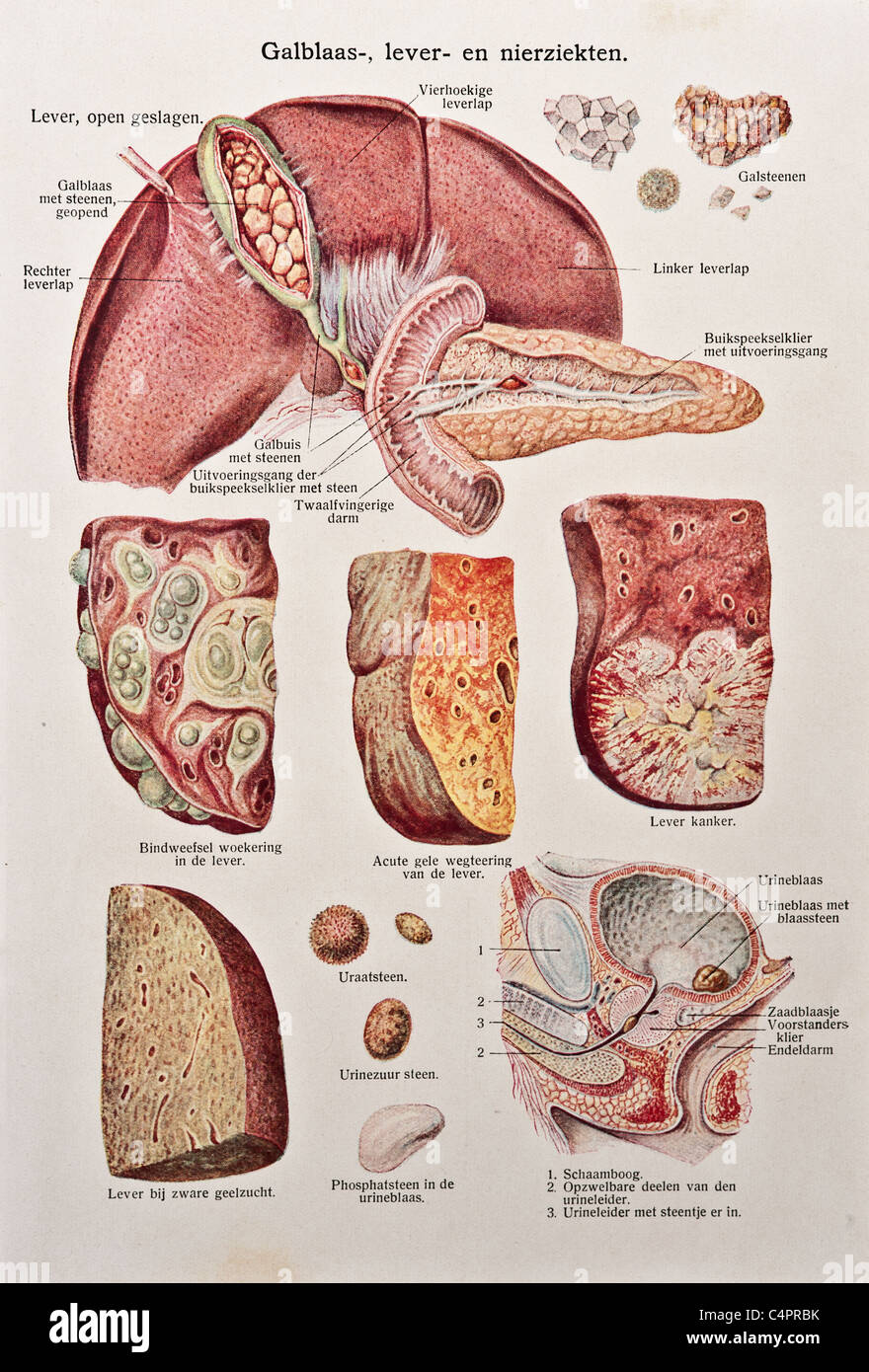 Galblaas Operatie Aan De Galblaas (Laparoscopische Galblaasoperatie)