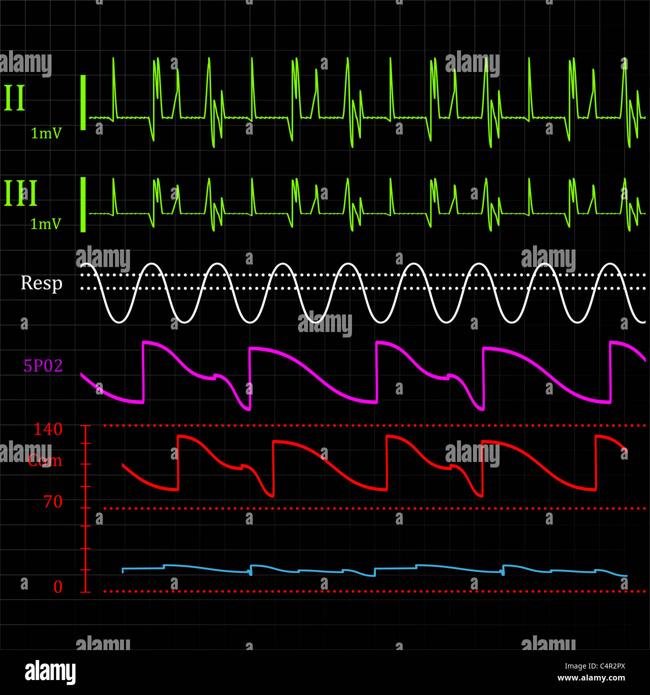 Physiologic monitor, abstract background illustration Stock Photo - Alamy