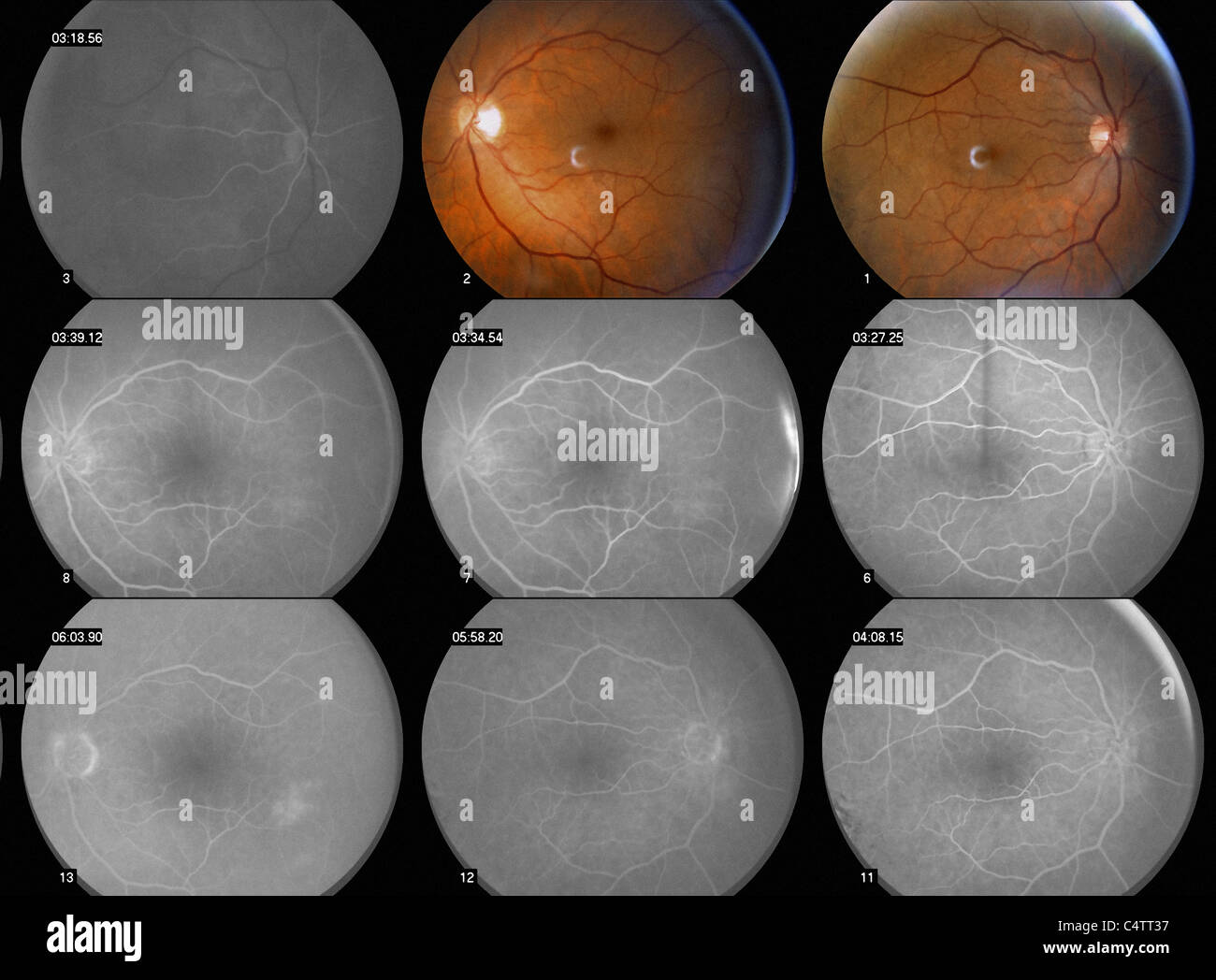 MY RETINA PHOTOS Stock Photo - Alamy